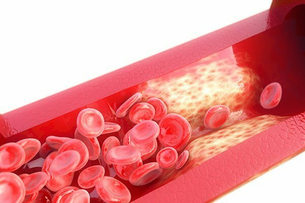 New High Blood Pressure Guidance Has Predominant Implications For 