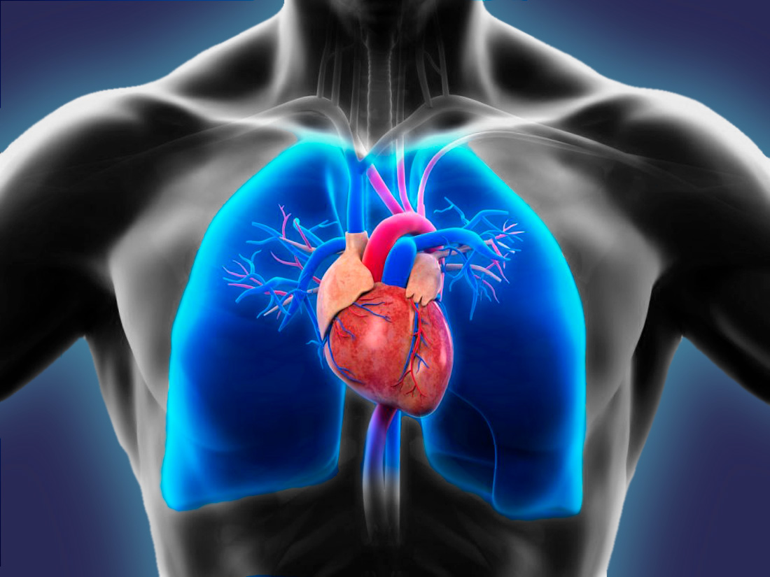Persistent pulmonary hypertension of the newborn - Dr Cardio Fit