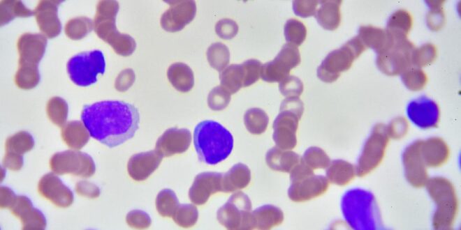 Unveiling the Power of Polymorphonuclear Cells: Understanding Their ...