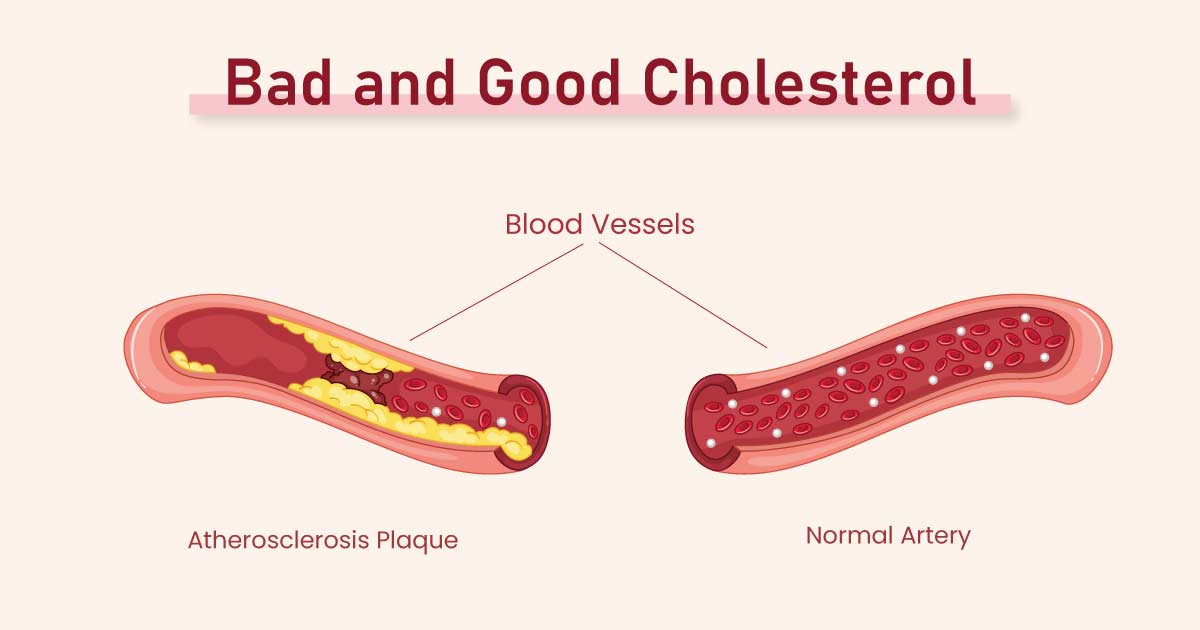Get the Scoop on Good Cholesterol vs. Bad Cholesterol! - Sazn World