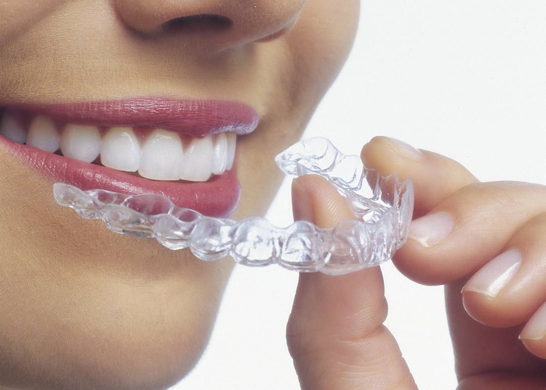 Understanding How Invisalign Aligners Are Made – And How To Care For Them