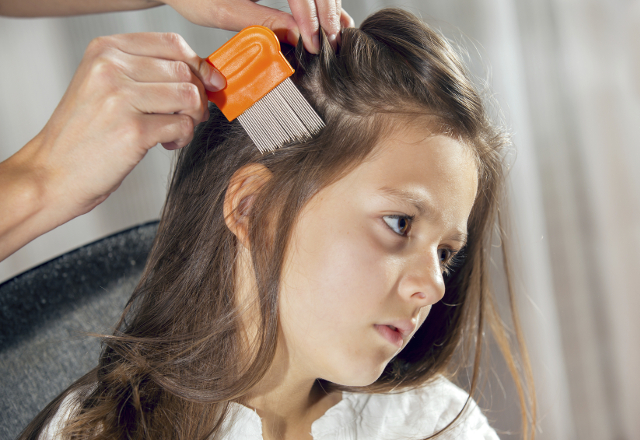 Powerful Head Lice Removal Tips